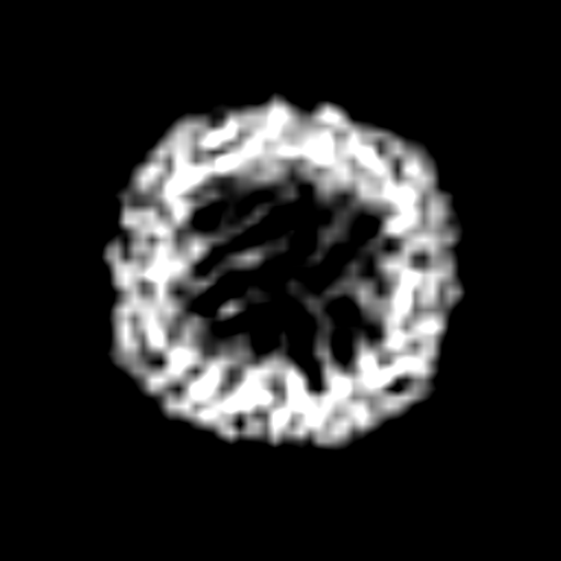 [CryoEM] high resolution 2D class images from cryoSPARC – KPWu's group ...