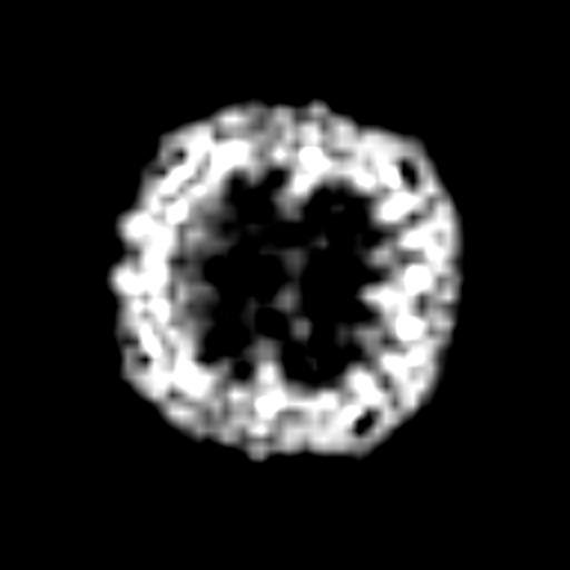 [CryoEM] high resolution 2D class images from cryoSPARC – KPWu's group ...
