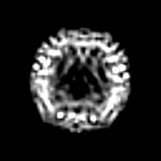 [CryoEM] high resolution 2D class images from cryoSPARC – KPWu's group ...